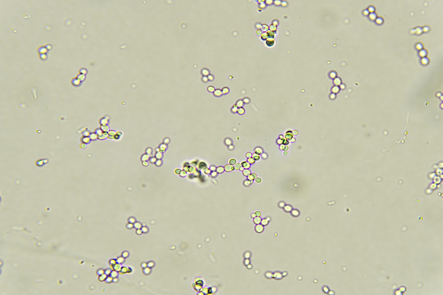 Yeast Cells Under Microscope