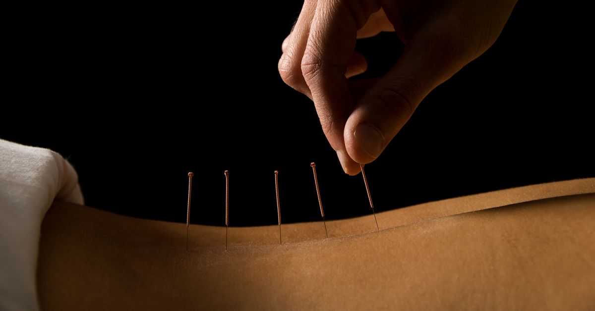 Acupuncture for Addiction & Withdrawal | Taste For Life